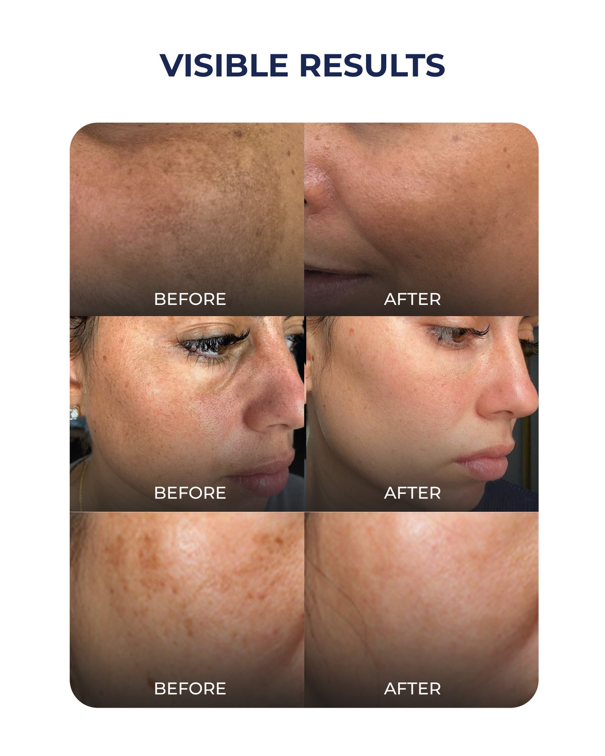 Multi-Active Discovery Kit for Brightening, Dark Spots, and Even Skin ...